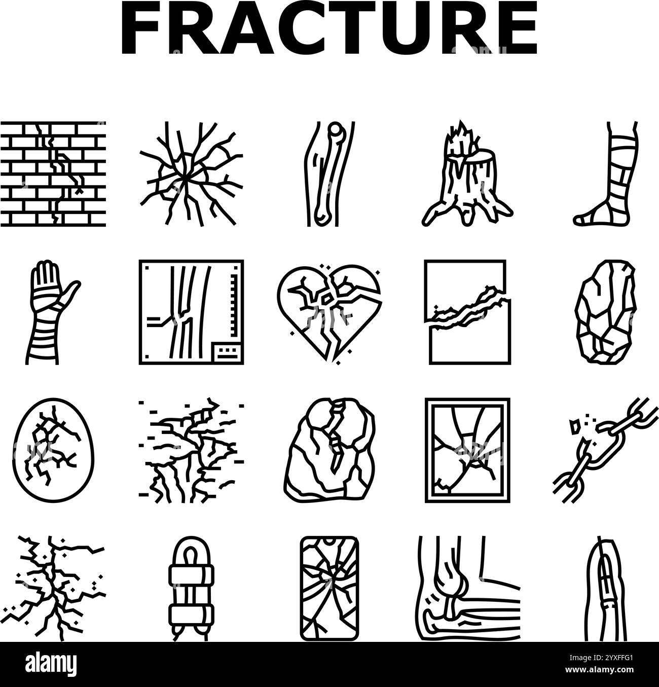 Stress fracture x ray hi-res stock photography and images - Alamy