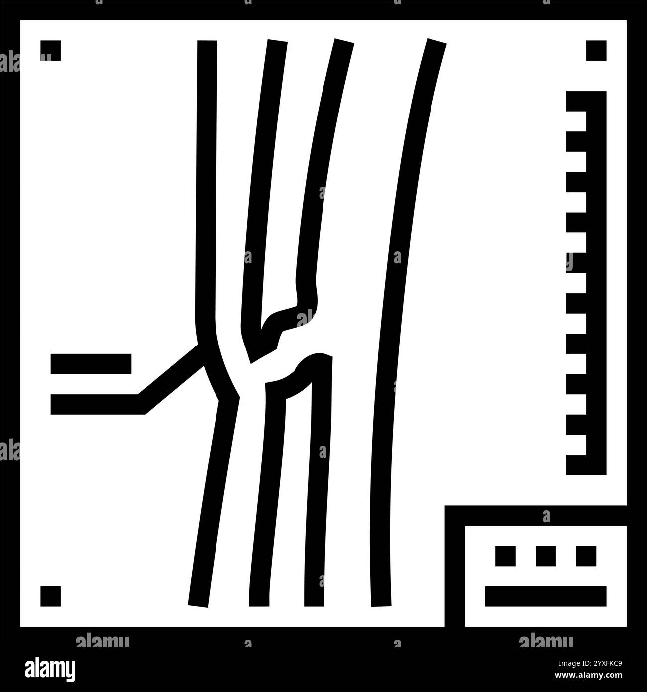Stress fracture x ray hi-res stock photography and images - Alamy