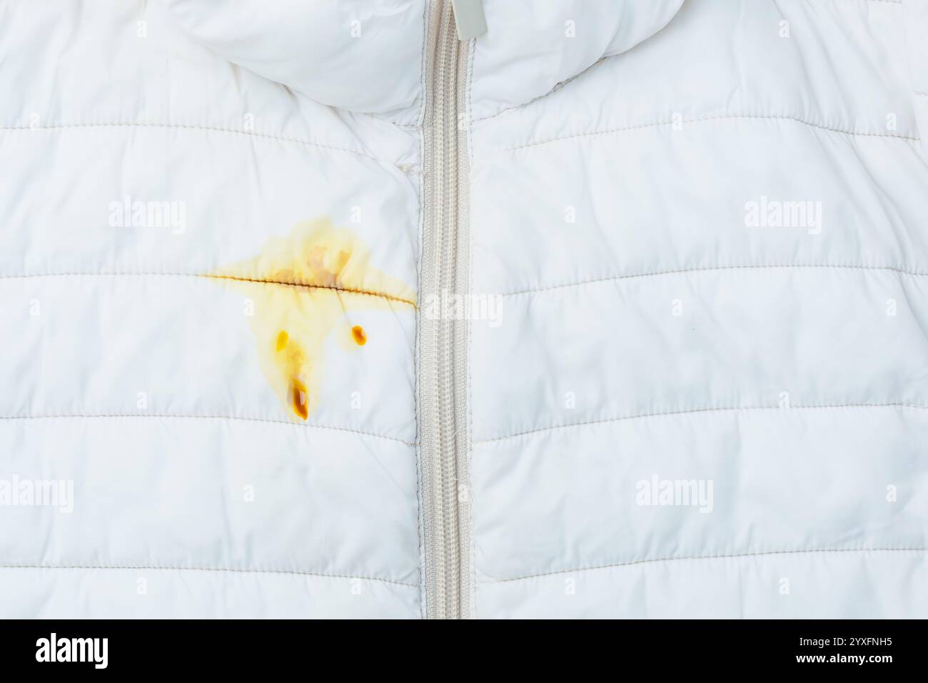 Dirty yellow stain on white outerwear during everyday activities. The ...