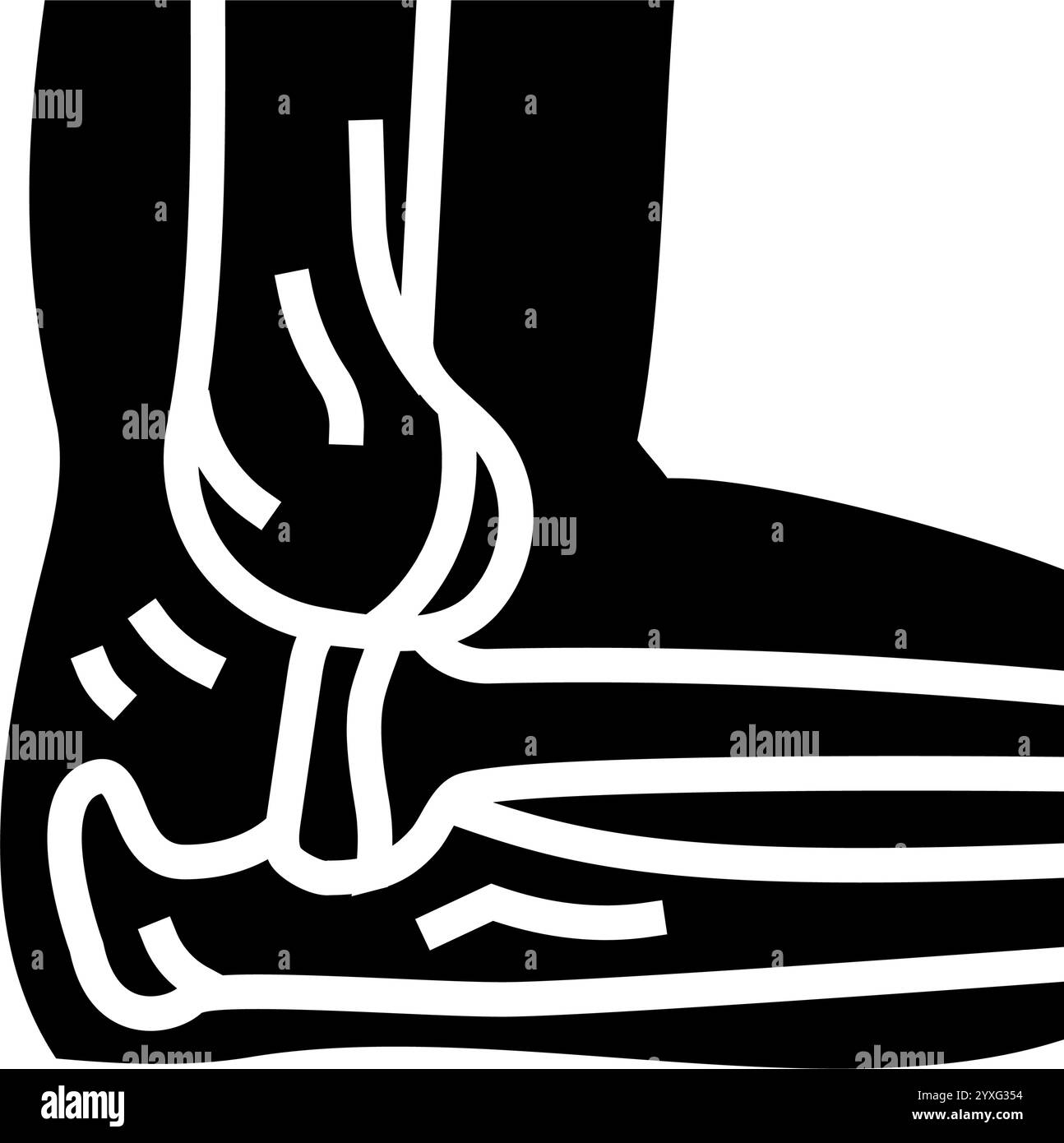 dislocated joint fracture glyph icon vector illustration Stock Vector ...