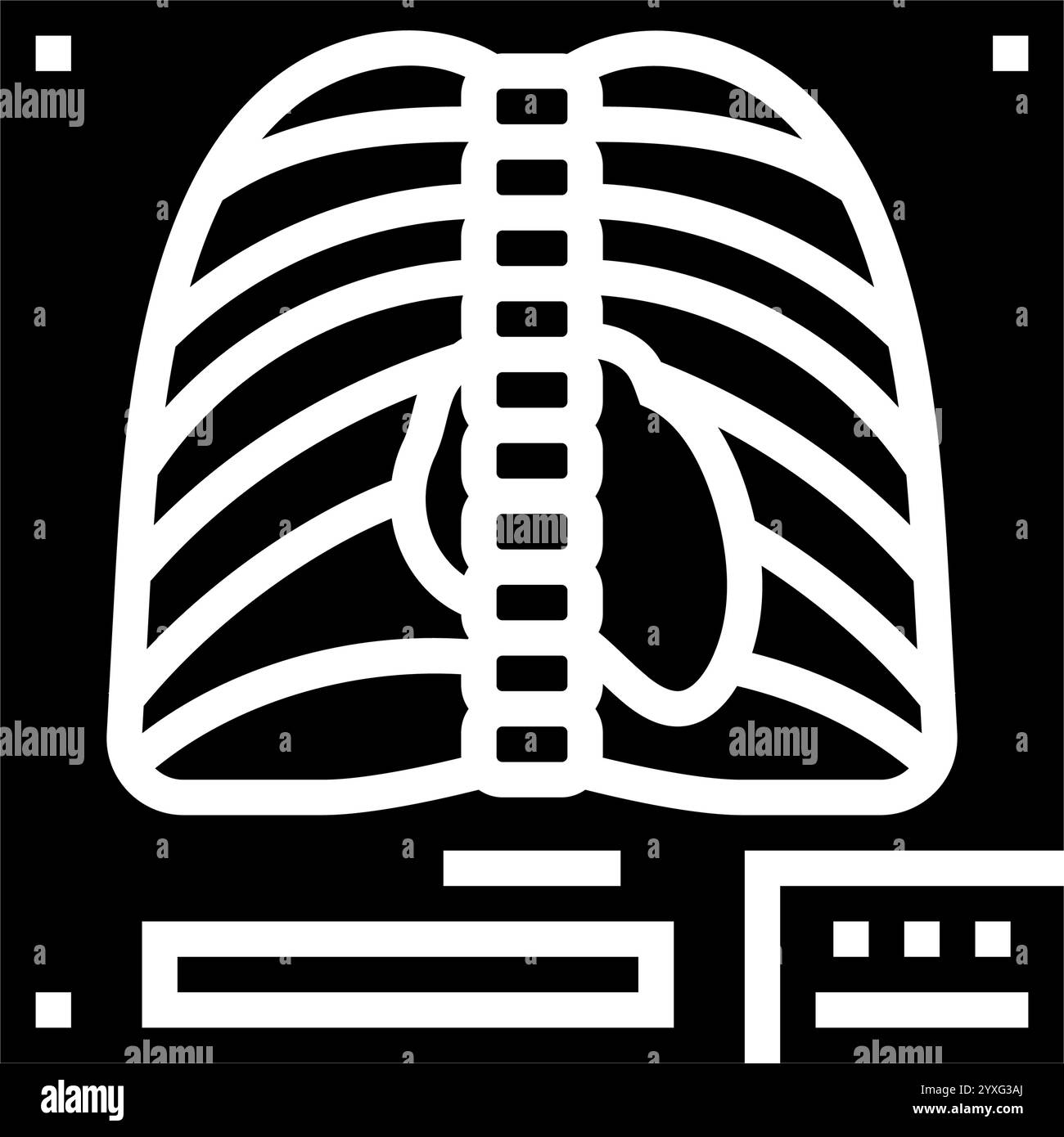 Stress fracture x ray hi-res stock photography and images - Alamy