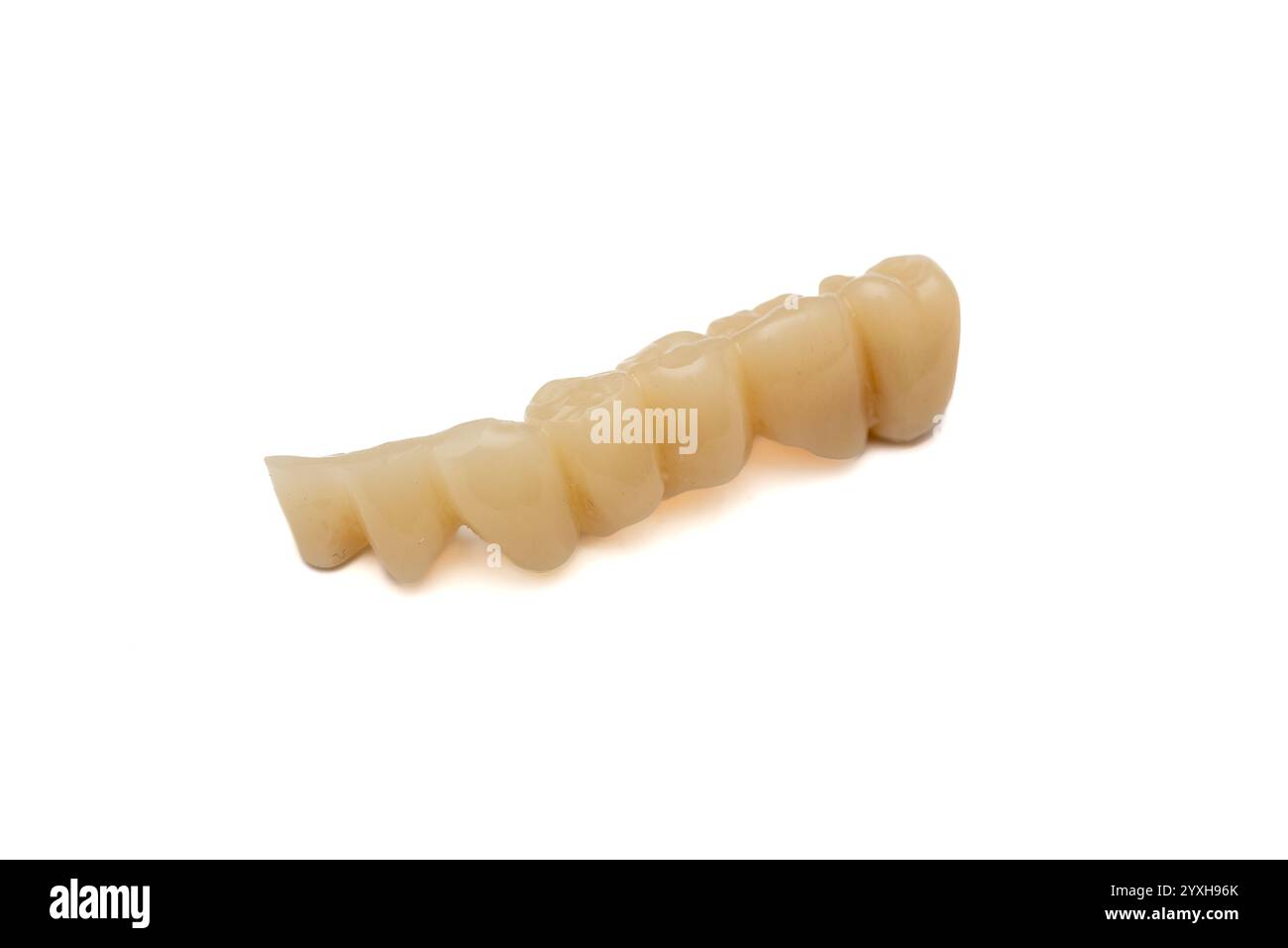 Dental Bridge - Isolated Prosthetic Teeth on White Background for ...