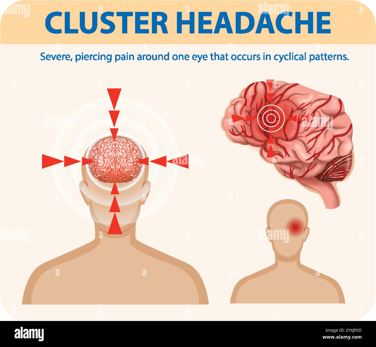 Pain management anatomy Stock Vector Images - Alamy