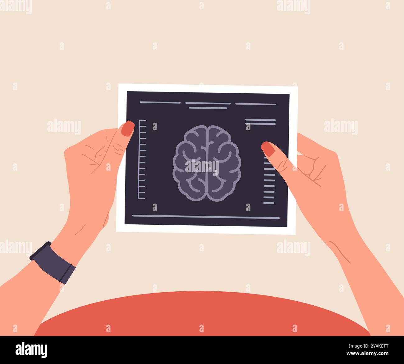 MRI scan. Female hands holding result of X-ray or MRI examination ...