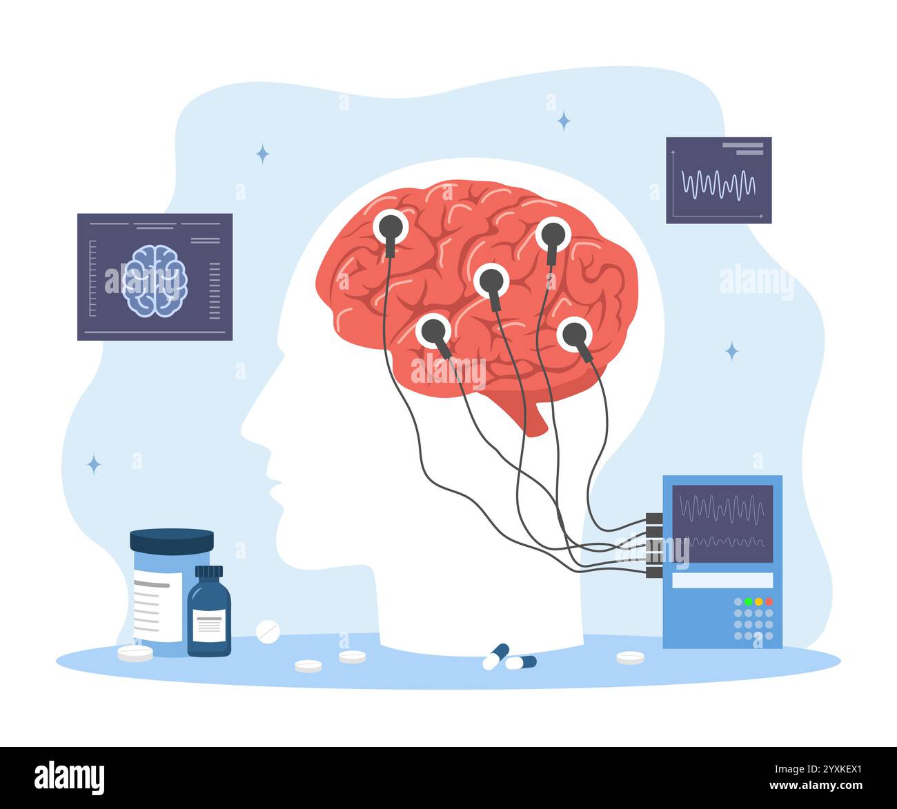 Epilepsy concept. Treatment nervous system. Electroencephalography ...