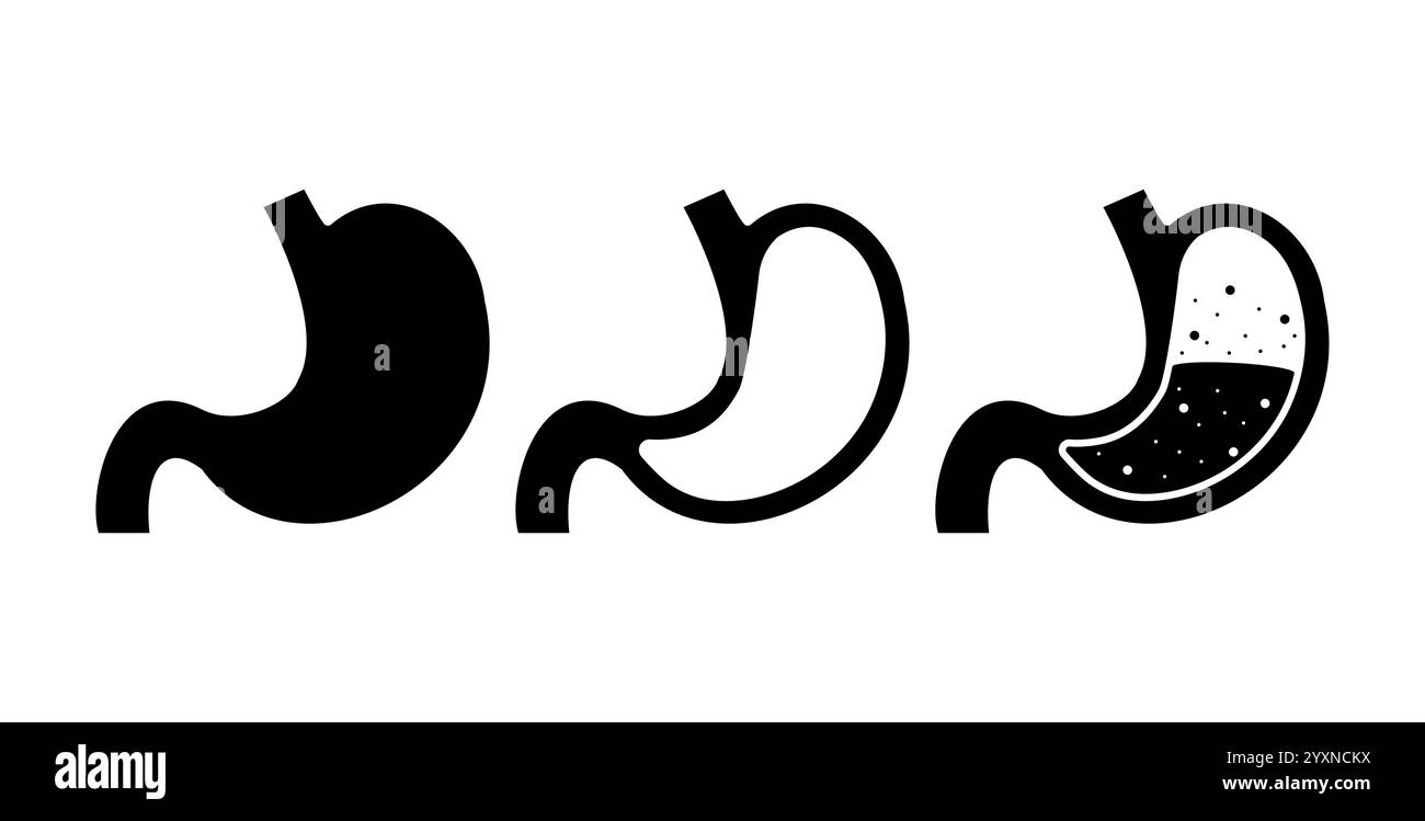 Human stomach showing fullness and different levels of digestion, black ...