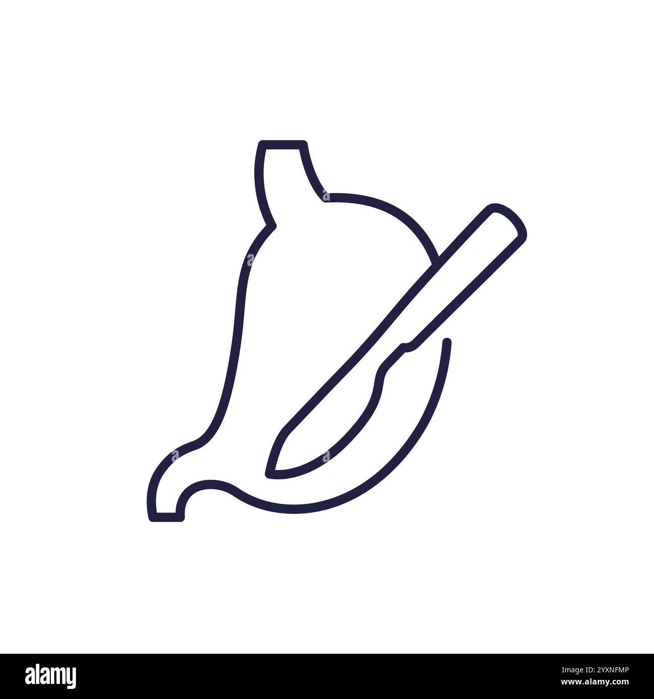Gastric bypass surgery Stock Vector Images - Alamy