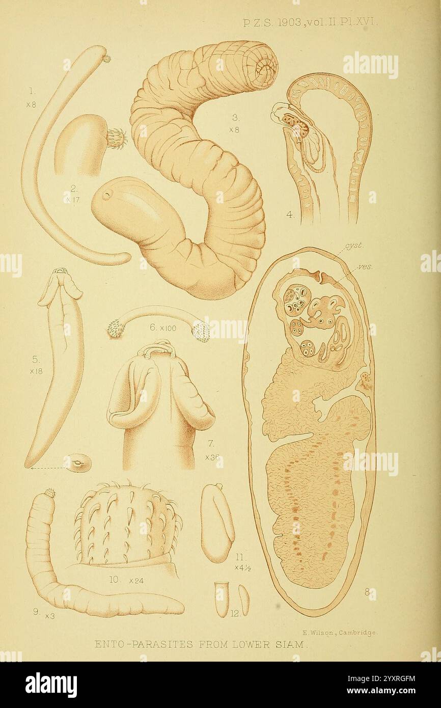 Cystic stages hi-res stock photography and images - Alamy