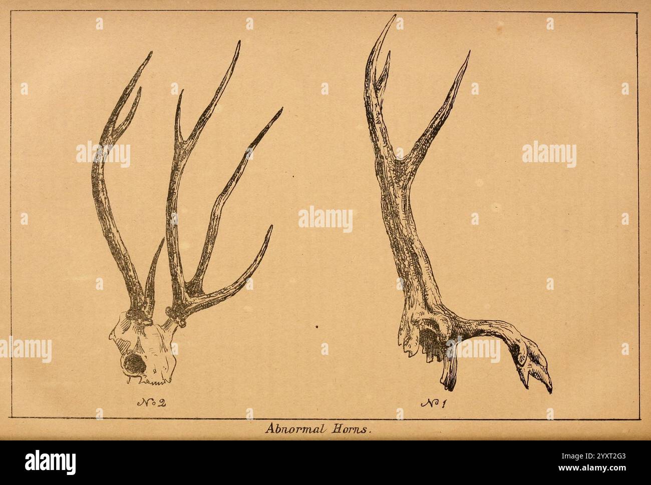 Abnormal skeletal features hi-res stock photography and images - Alamy
