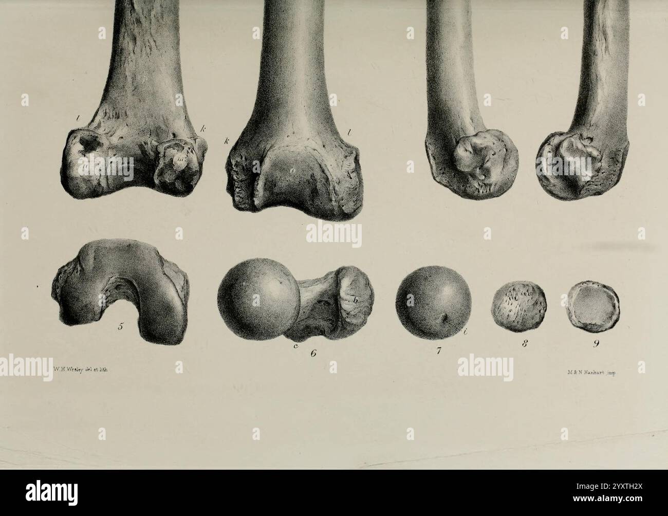 Ossification centers hi-res stock photography and images - Alamy