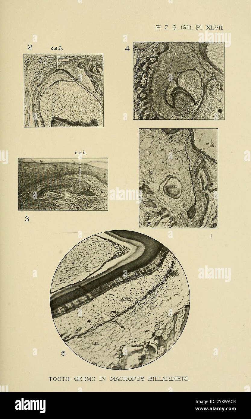 Dental growth stages hi-res stock photography and images - Alamy