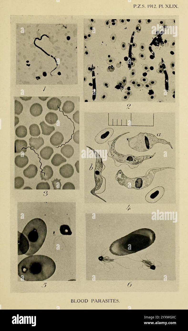 Parasites within red blood cell morphology hi-res stock photography and ...