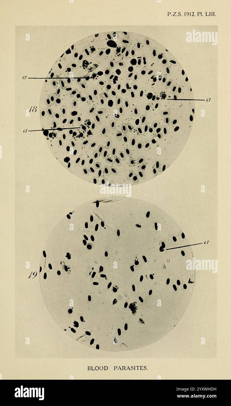 Hematological studies hi-res stock photography and images - Alamy