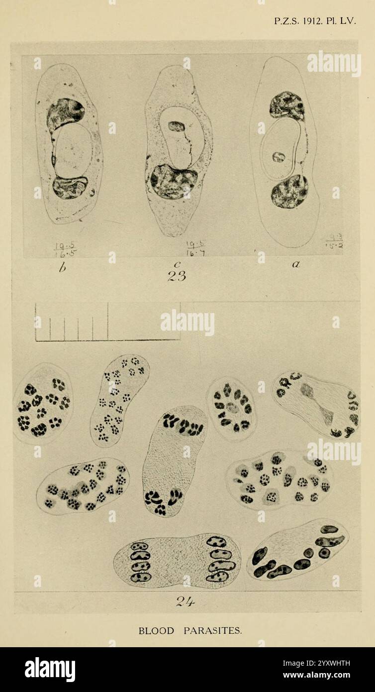 Larger section features numerous blood parasite forms hi-res stock ...