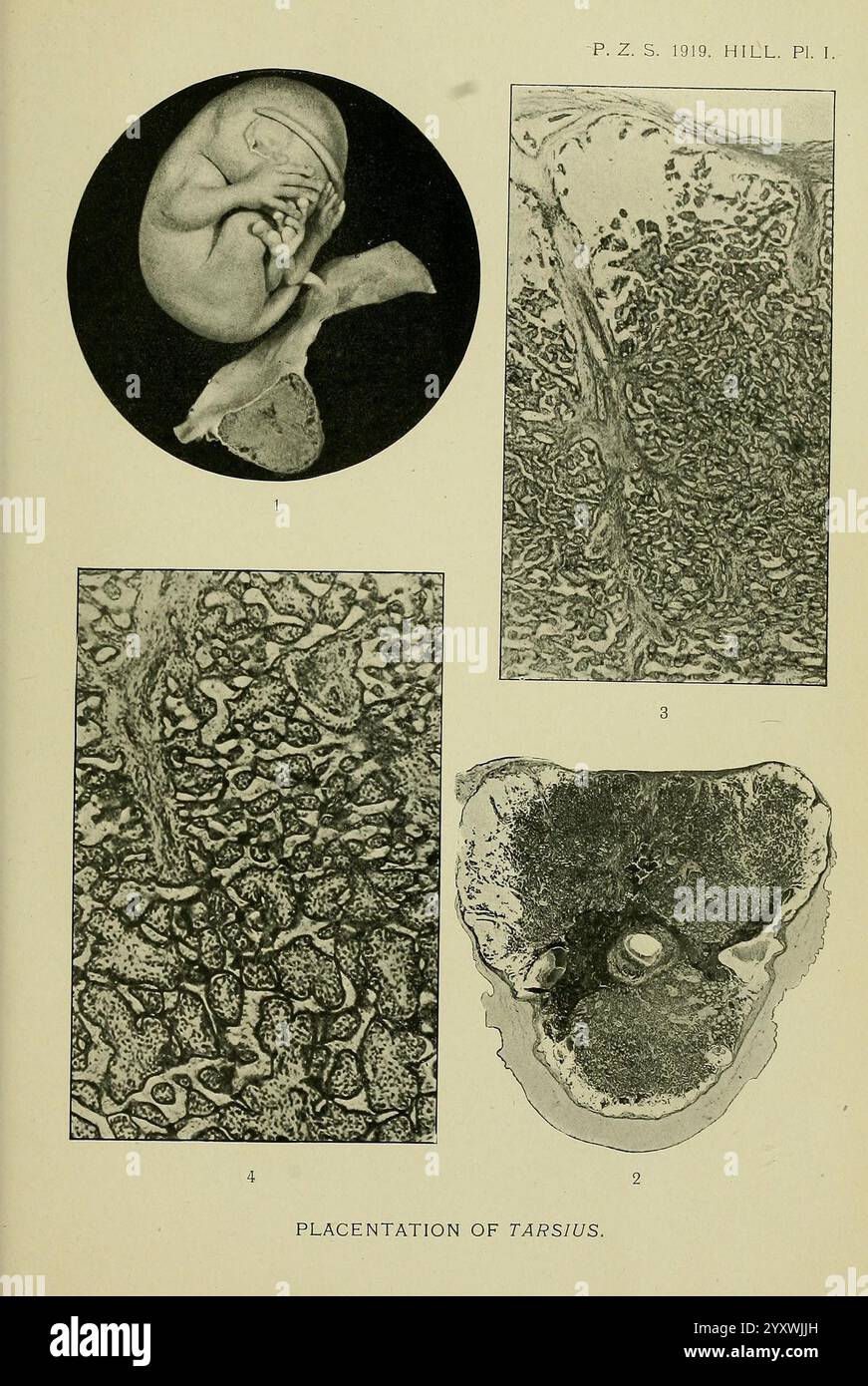 Placentation hi-res stock photography and images - Alamy