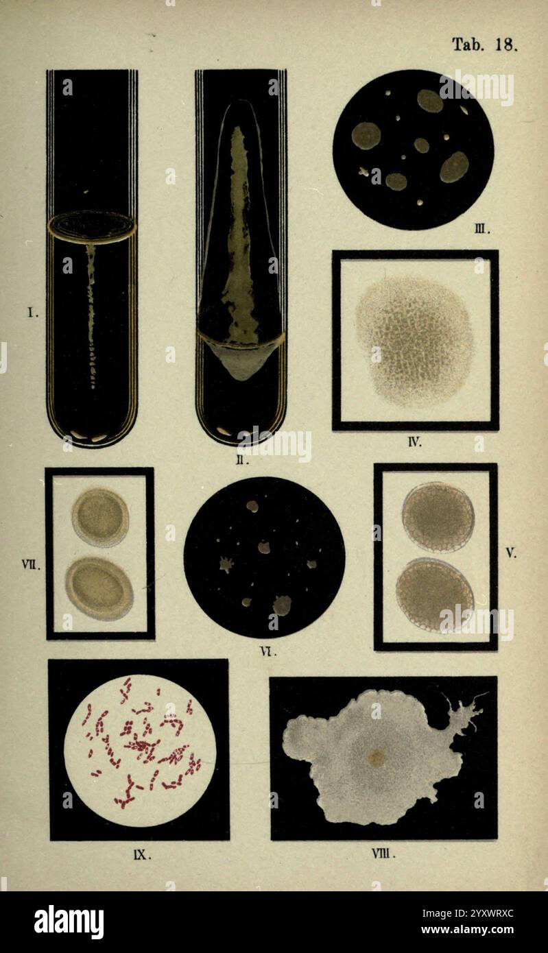 Indicating bacterial growth hi-res stock photography and images - Alamy