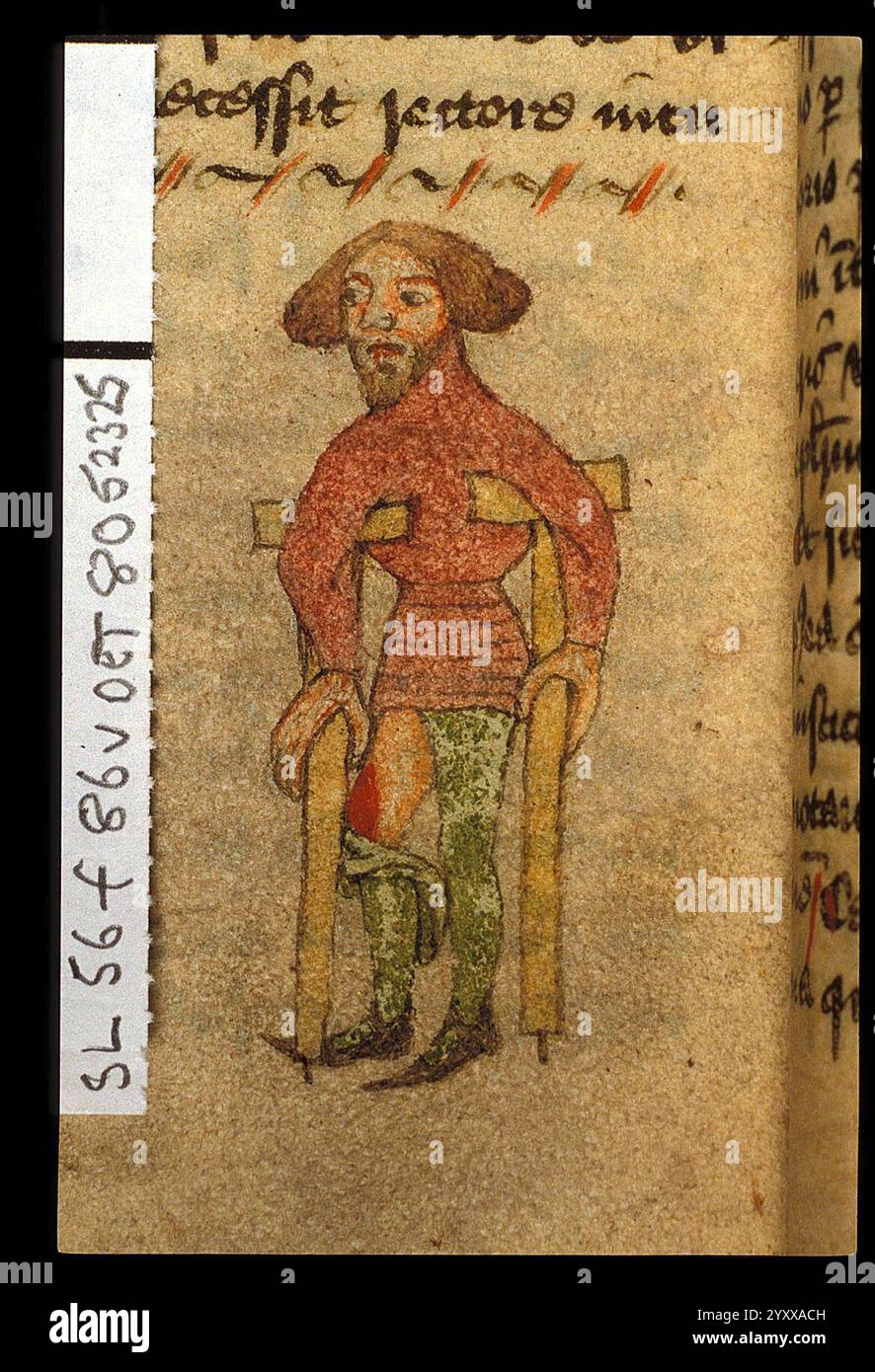 Detail of a drawing of a man on crutches in John Arderne's Liber ...