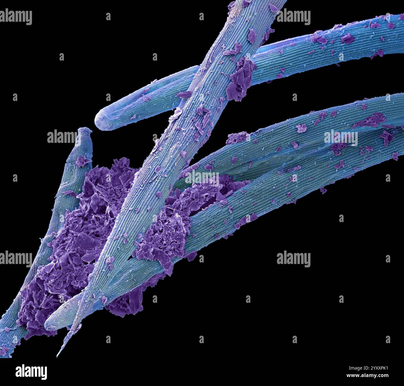 Nematodes. Coloured scanning electron micrograph (SEM) of ...