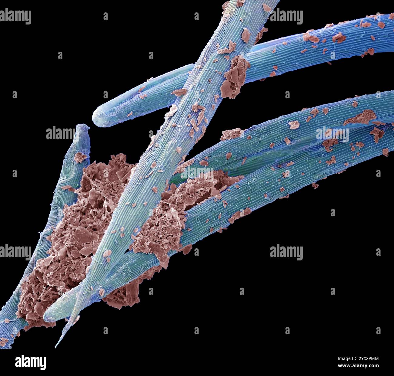 Nematodes. Coloured scanning electron micrograph (SEM) of ...
