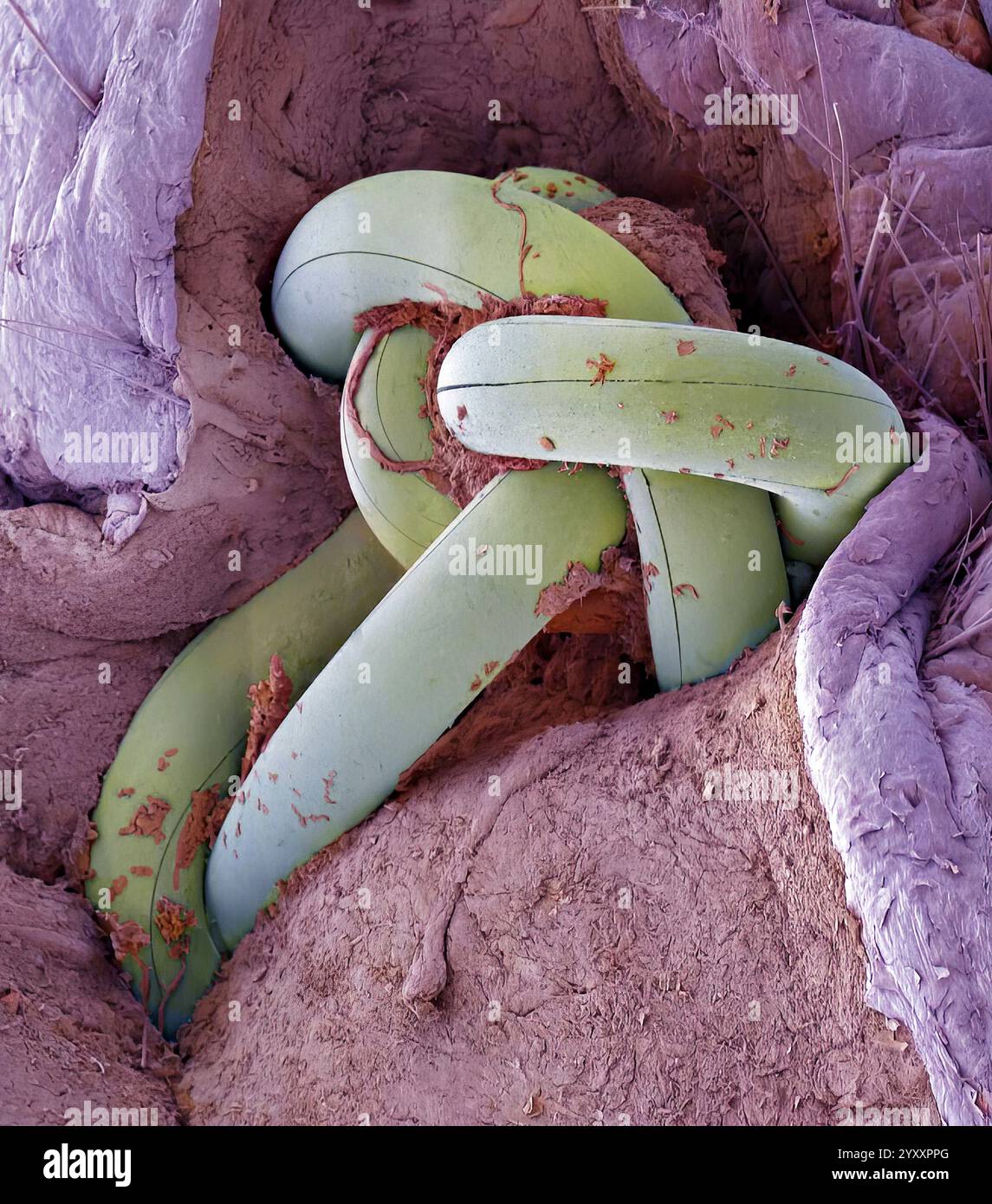 Sutured wound. Coloured scanning electron micrograph (SEM) of a suture ...