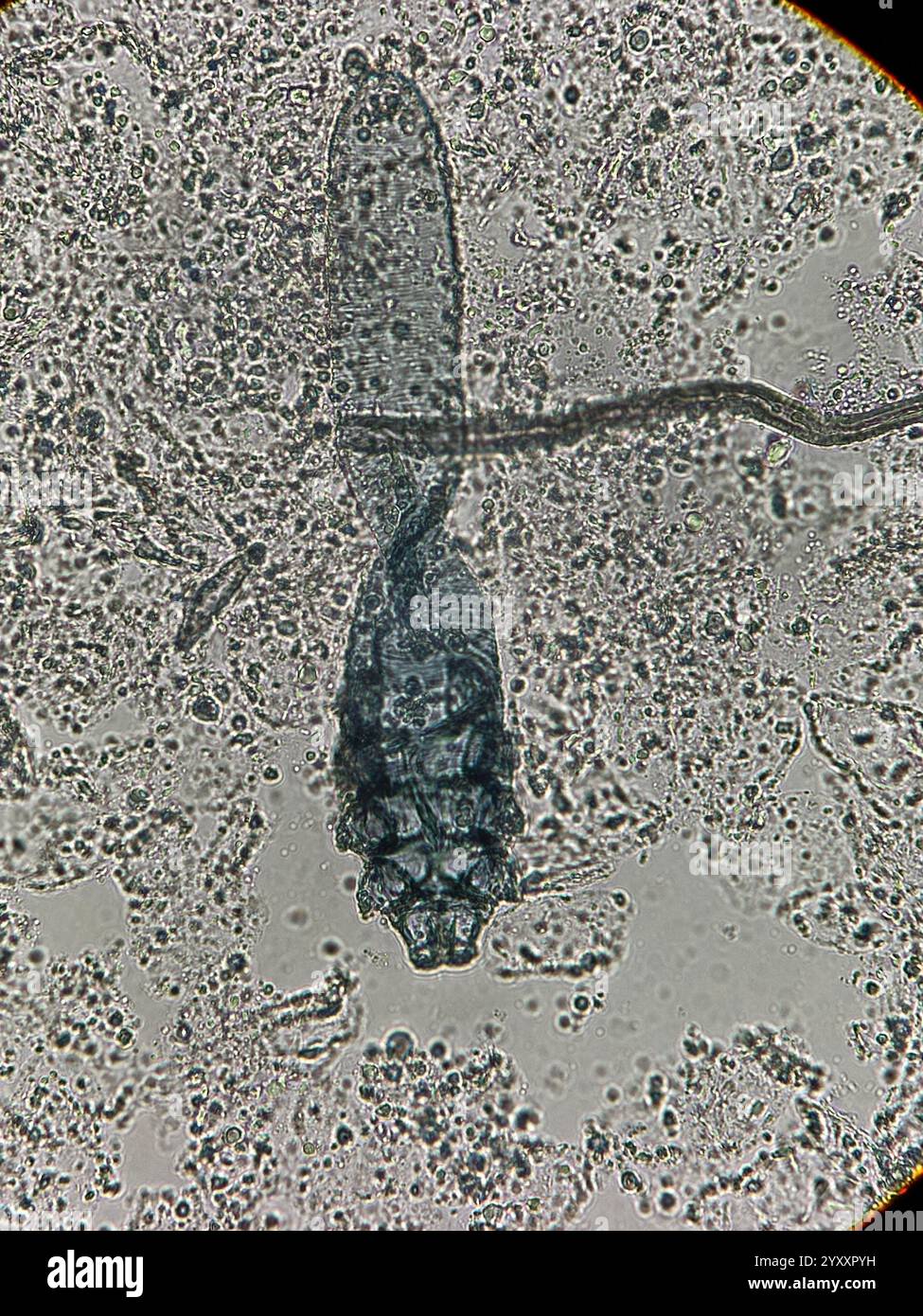 Light micrograph of a human hair follicle mite (Demodex sp.). This ...