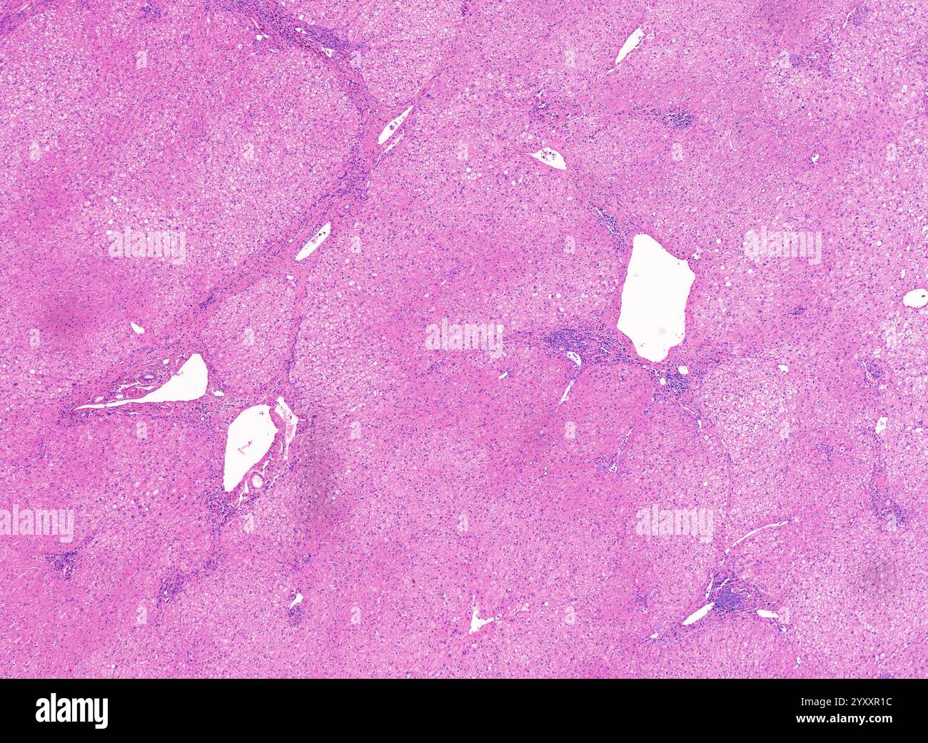 Human liver tissue, light micrograph Stock Photo - Alamy