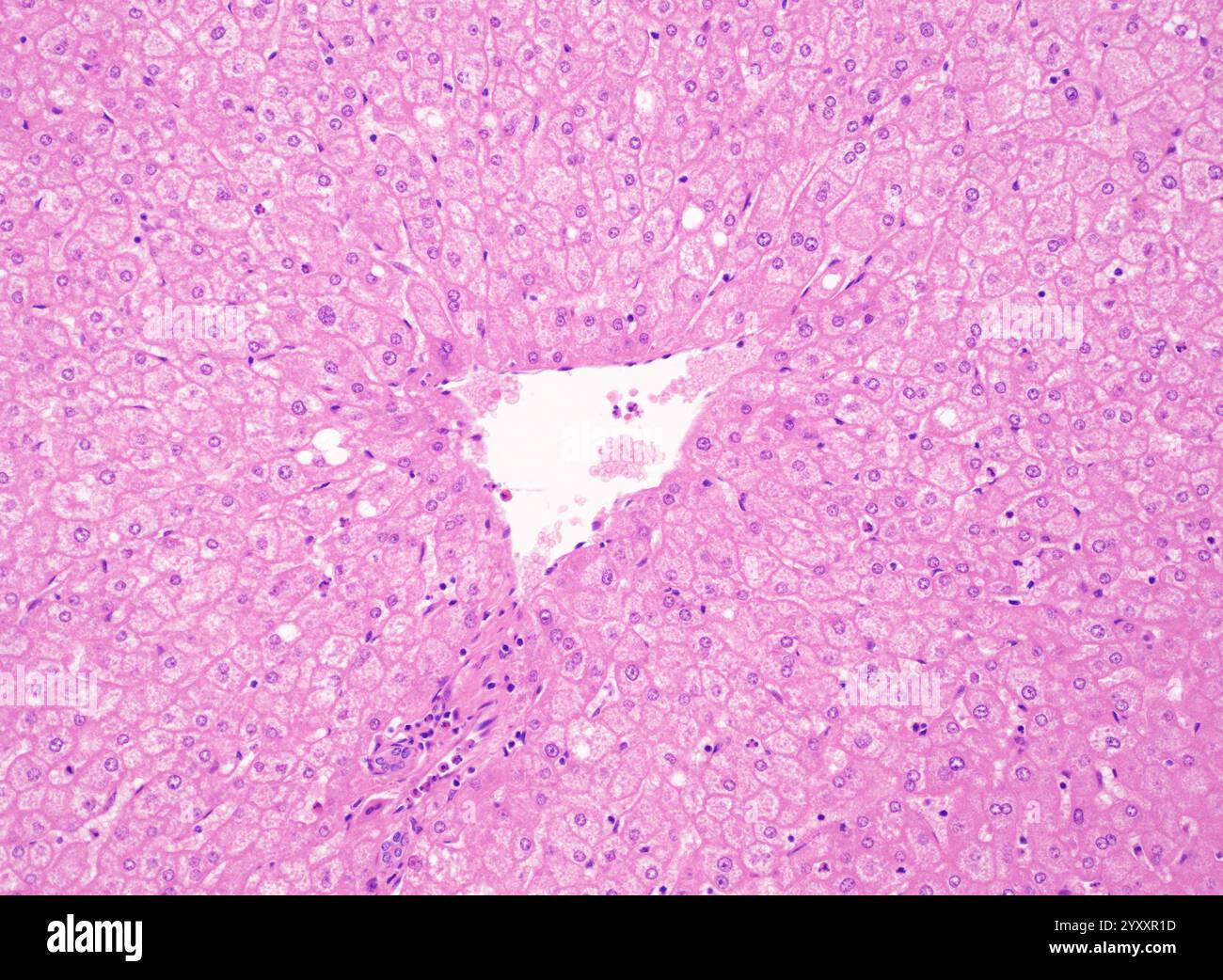 Human liver tissue, light micrograph Stock Photo - Alamy