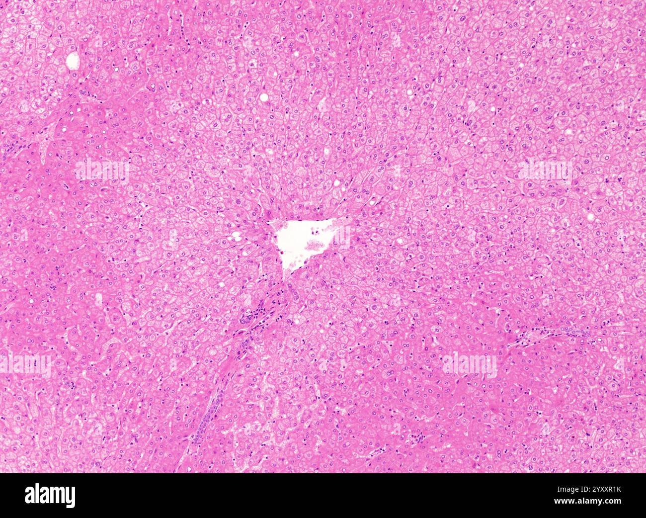 Human liver tissue, light micrograph Stock Photo - Alamy