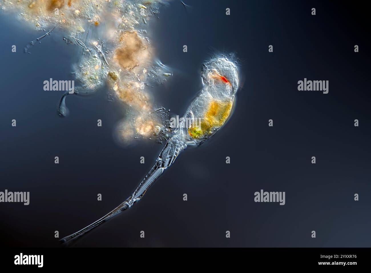 Differential interference contrast (DIC) light micrograph of a Rotifer ...