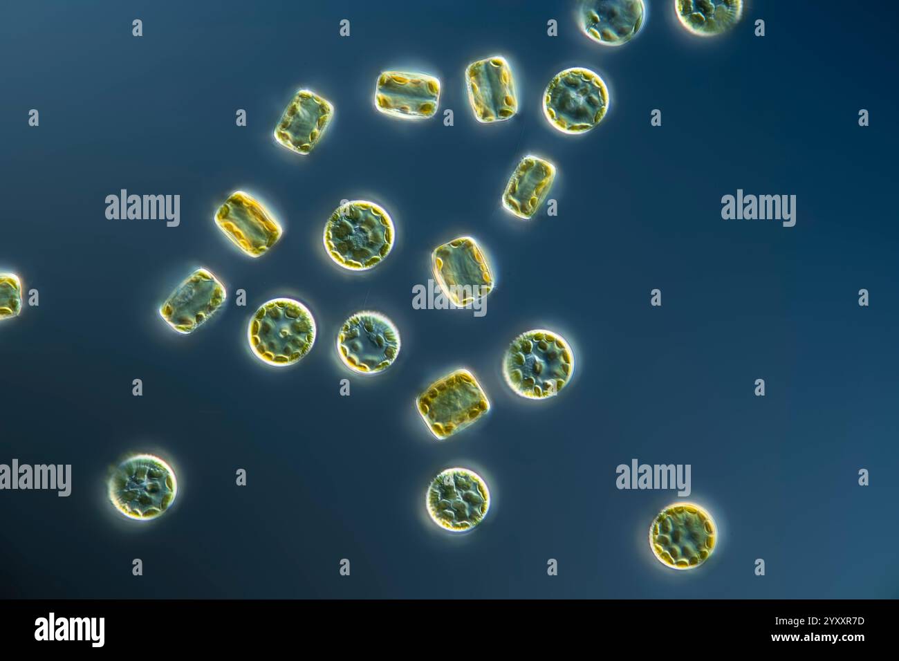 Differential interference contrast (DIC) light micrograph of ...