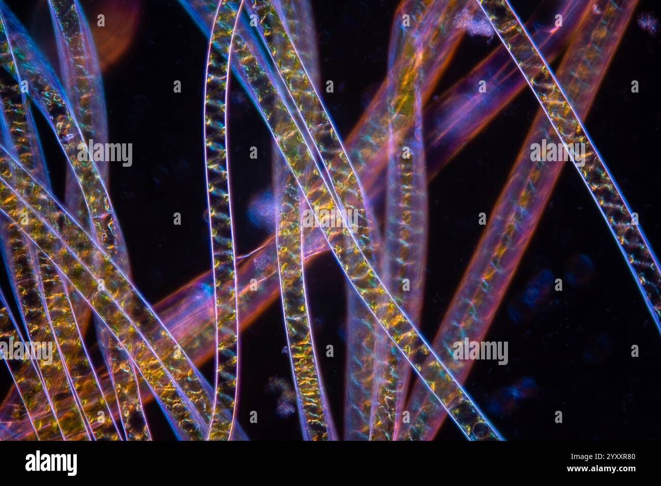 Darkfield and polarised light micrograph of Spirogyra sp. algae ...