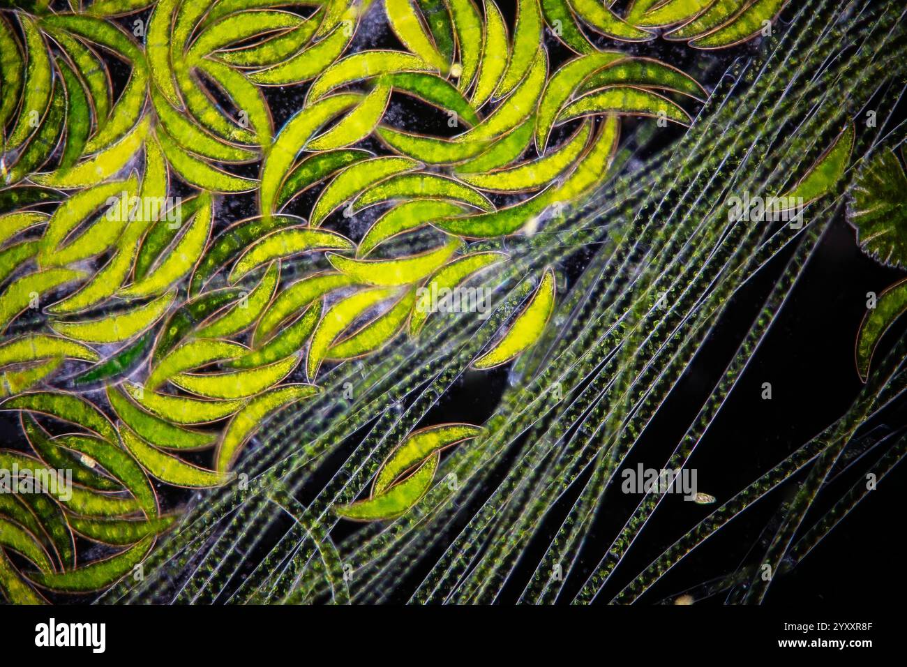 Darkfield and polarised light micrograph of Spirogyra sp. and ...
