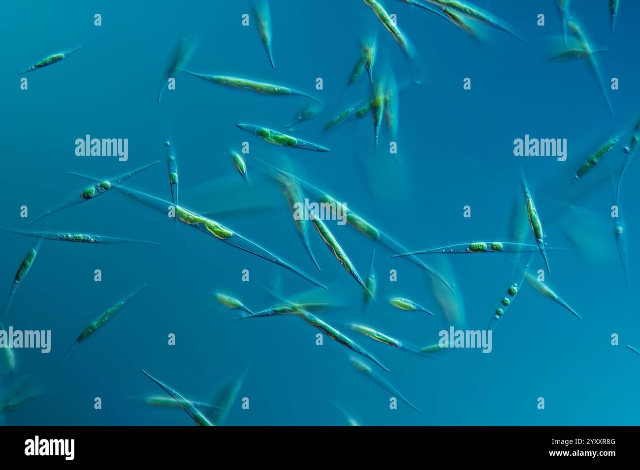 Differential interference contrast (DIC) light micrograph of ...
