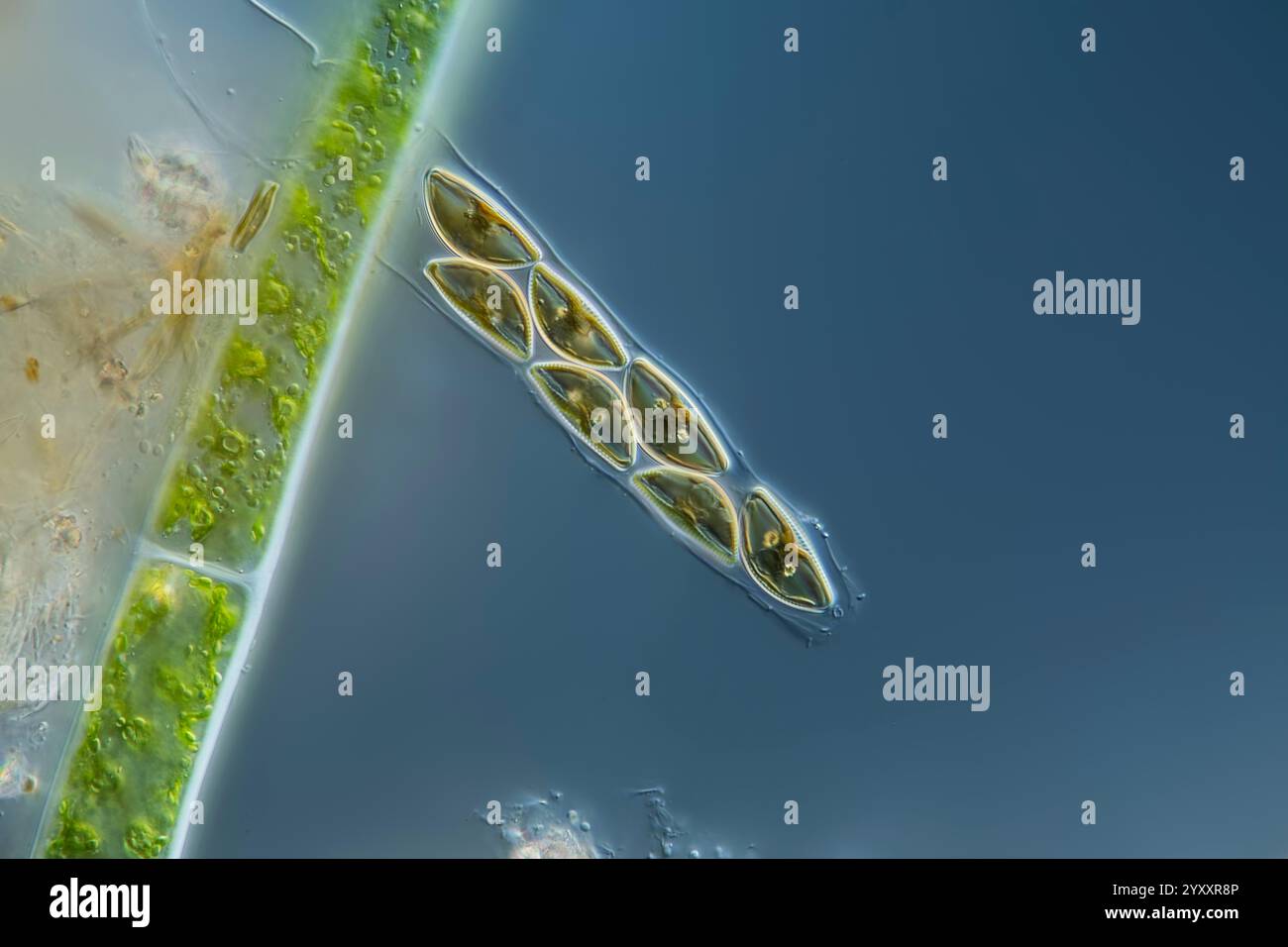 Differential interference contrast (DIC) light micrograph of a diatom ...