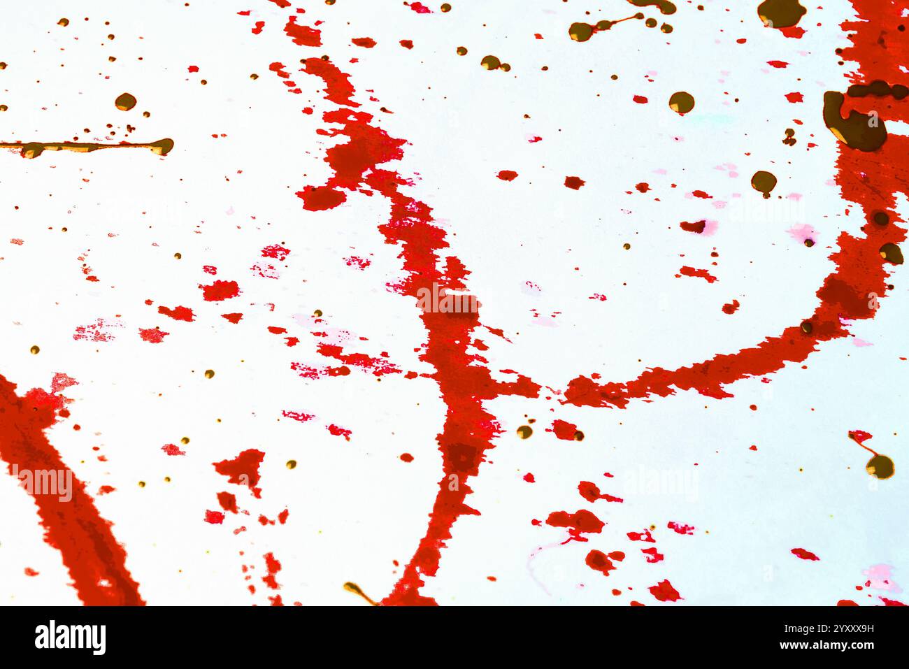 AIDS. Blood Donation. Donor of blood. World AIDS day. Bloody mess. Full ...