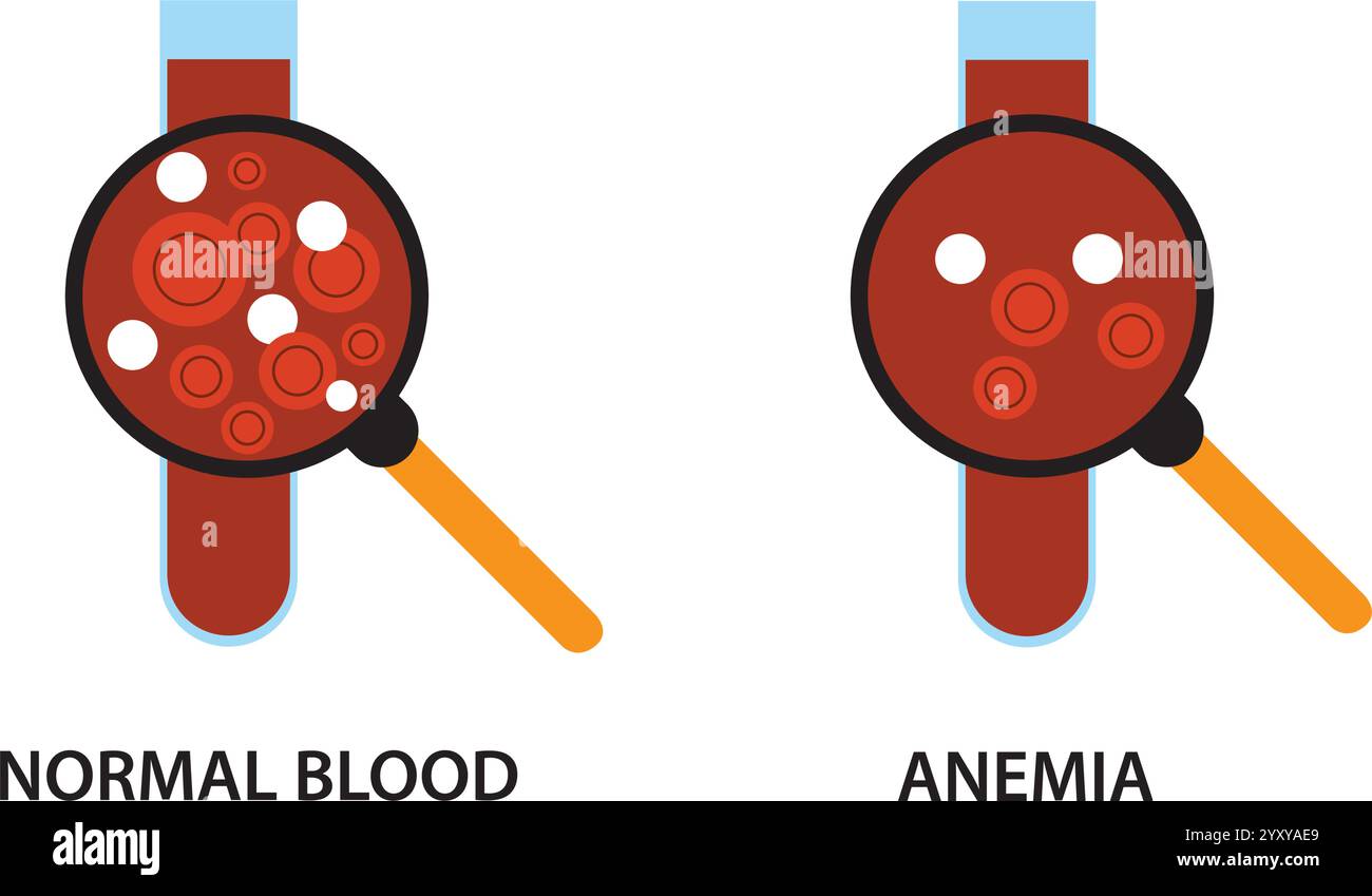 Anemia problem circulatory iron body diagram background. Anaemia ...