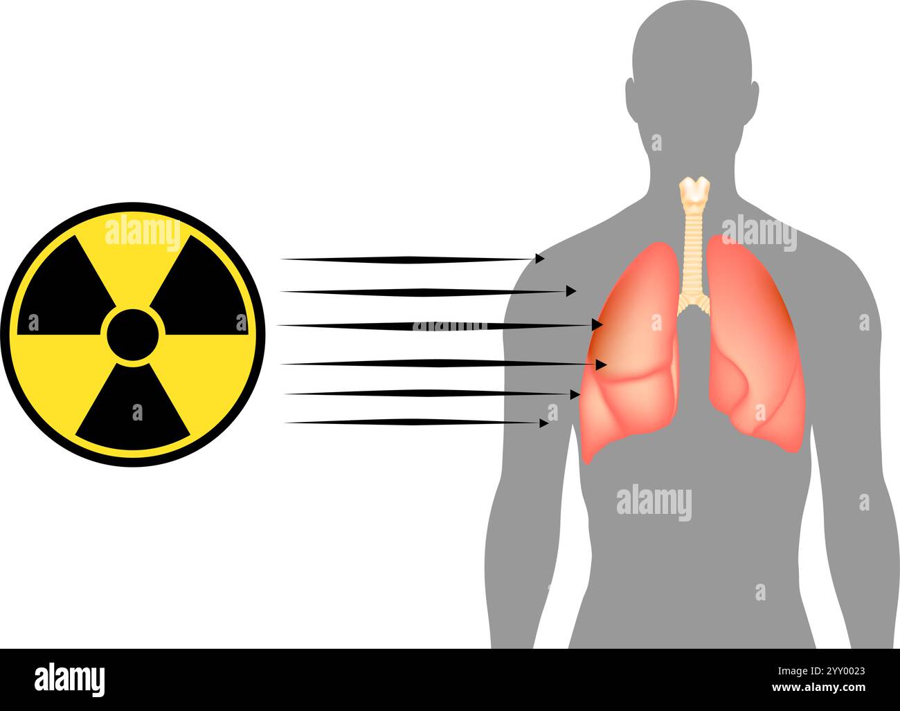 Radiation Exposure on Human Lungs. Human Body Radiation Penetration ...