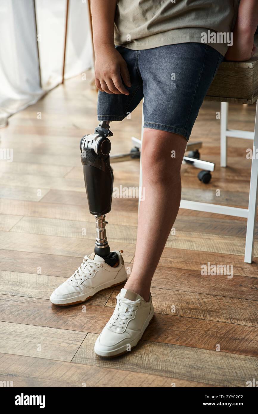 A young handsome man is confidently seated with a prosthetic leg on ...