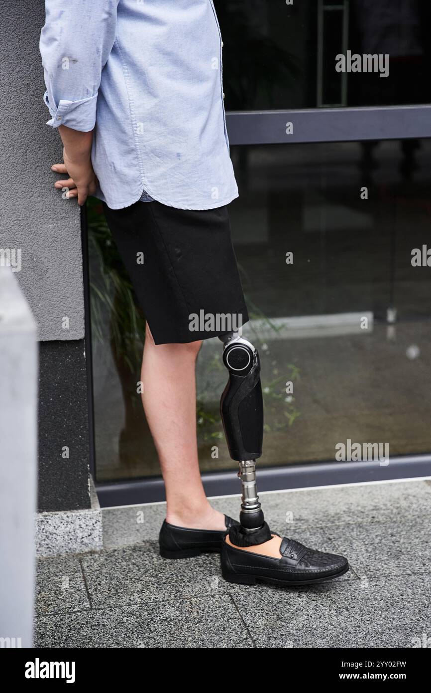 A young handsome man with a prosthetic leg stands outside a modern ...
