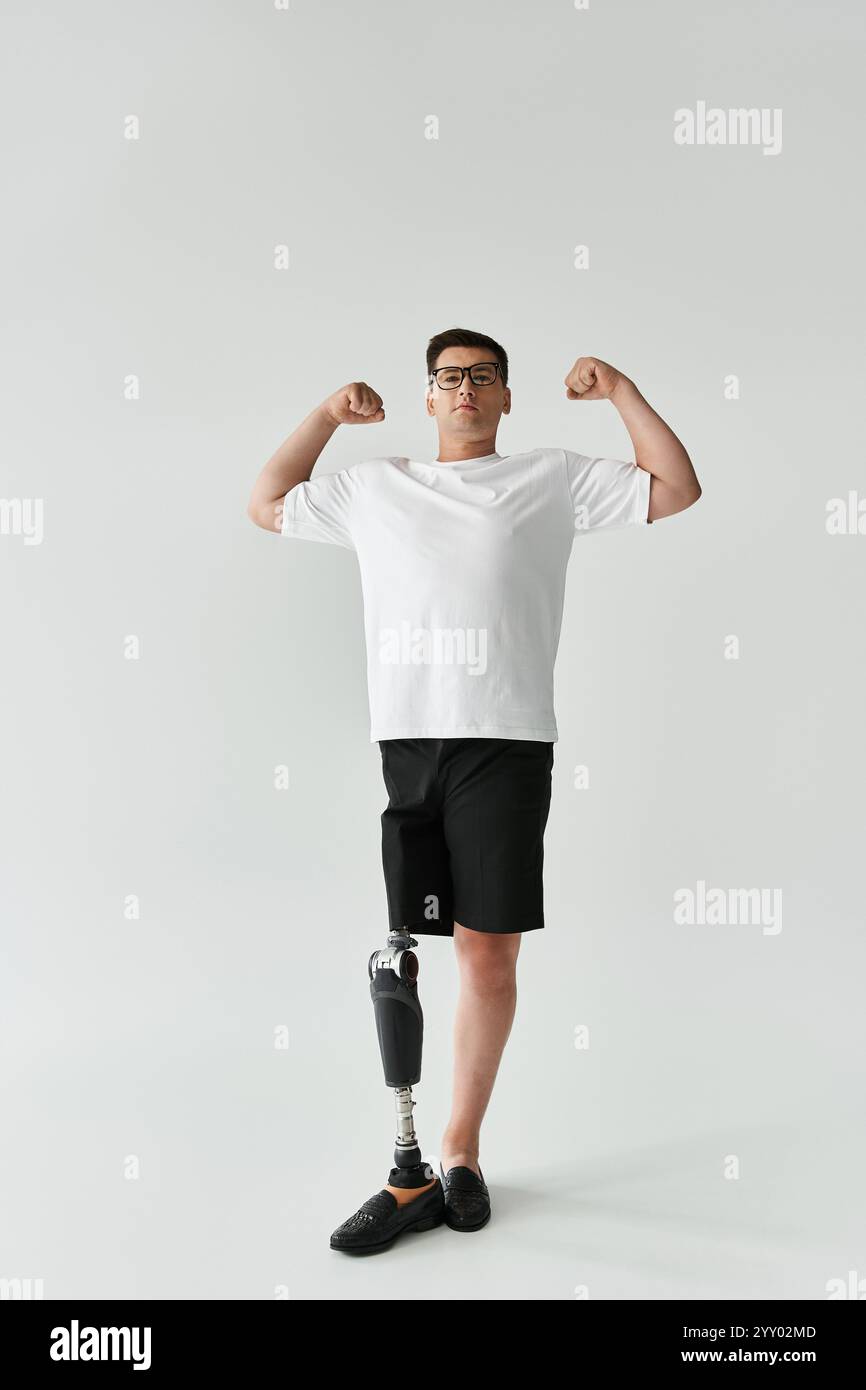Young man with a prosthetic leg proudly flexes his muscles in a bright ...