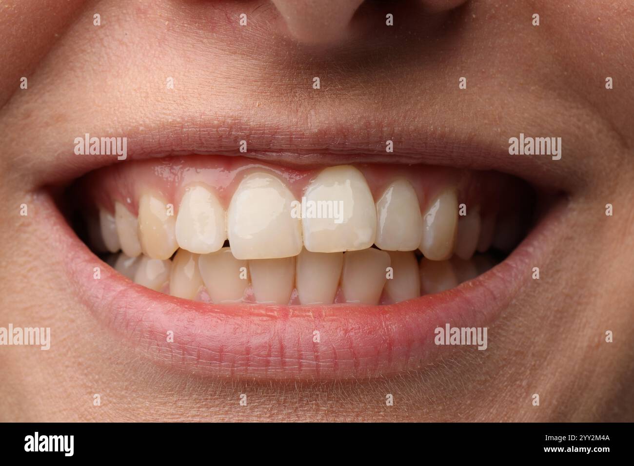 Healthy teeth hi-res stock photography and images - Alamy
