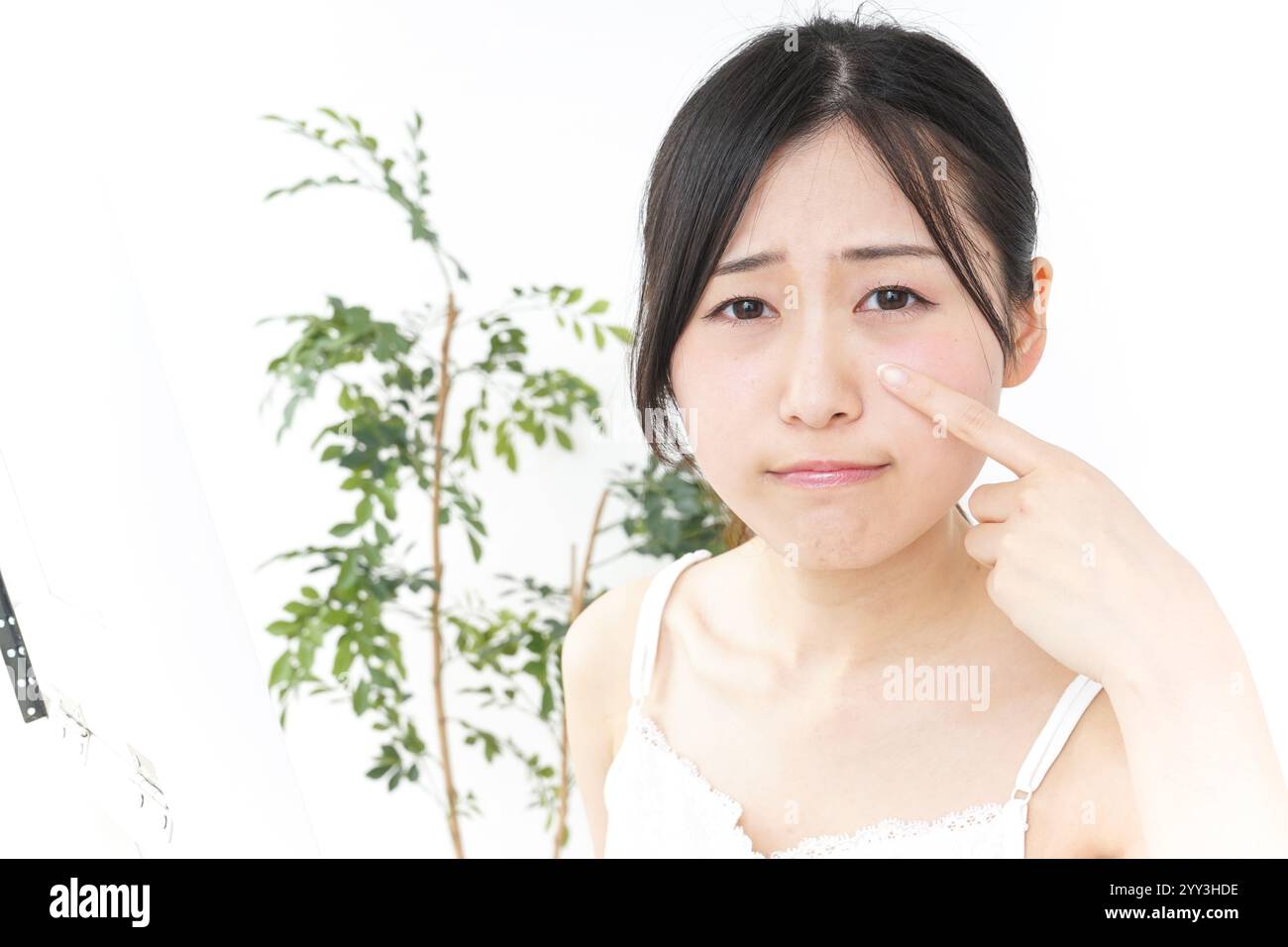 Acne and skin problems Stock Photo - Alamy