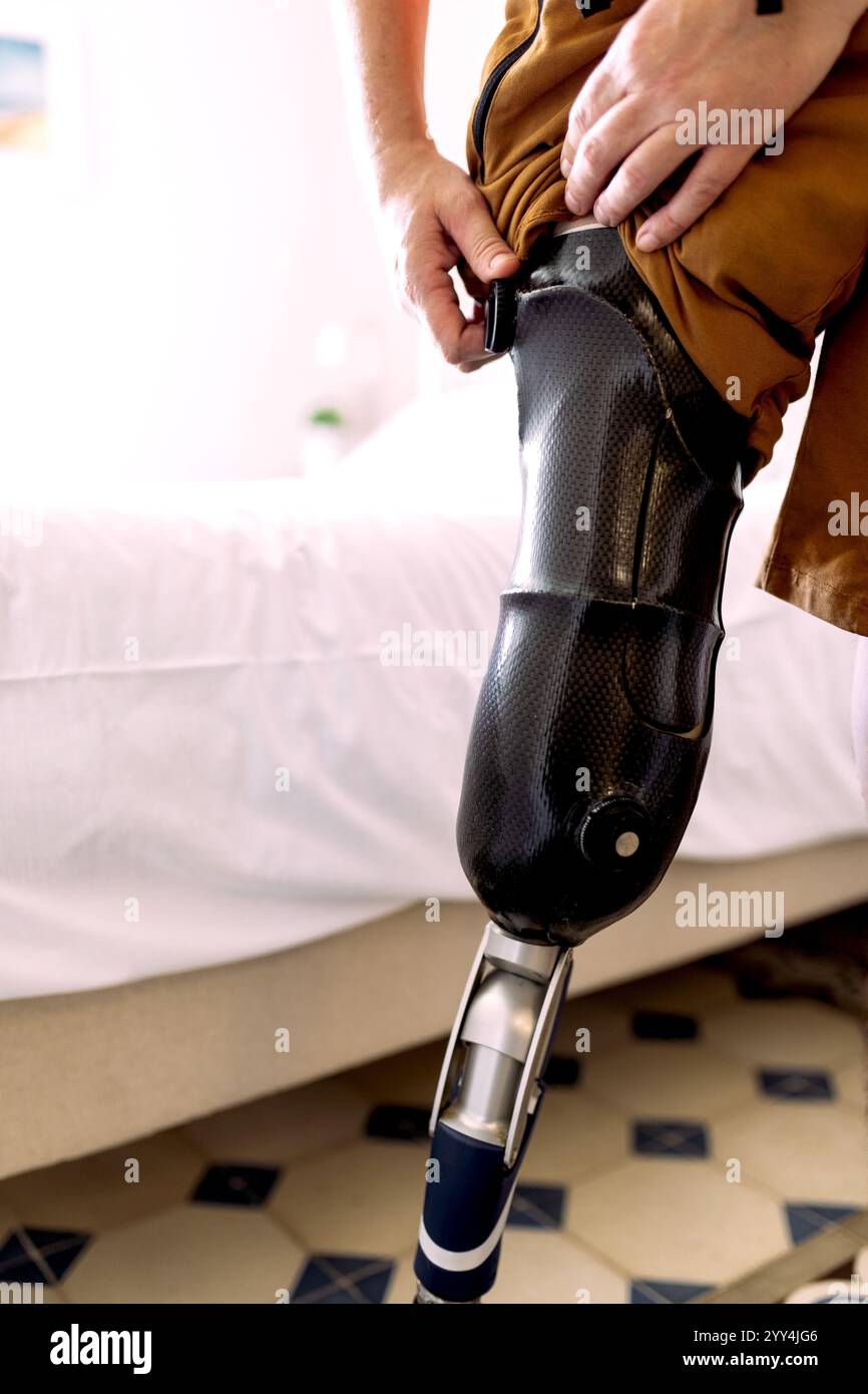 High tech prosthetic hi-res stock photography and images - Alamy