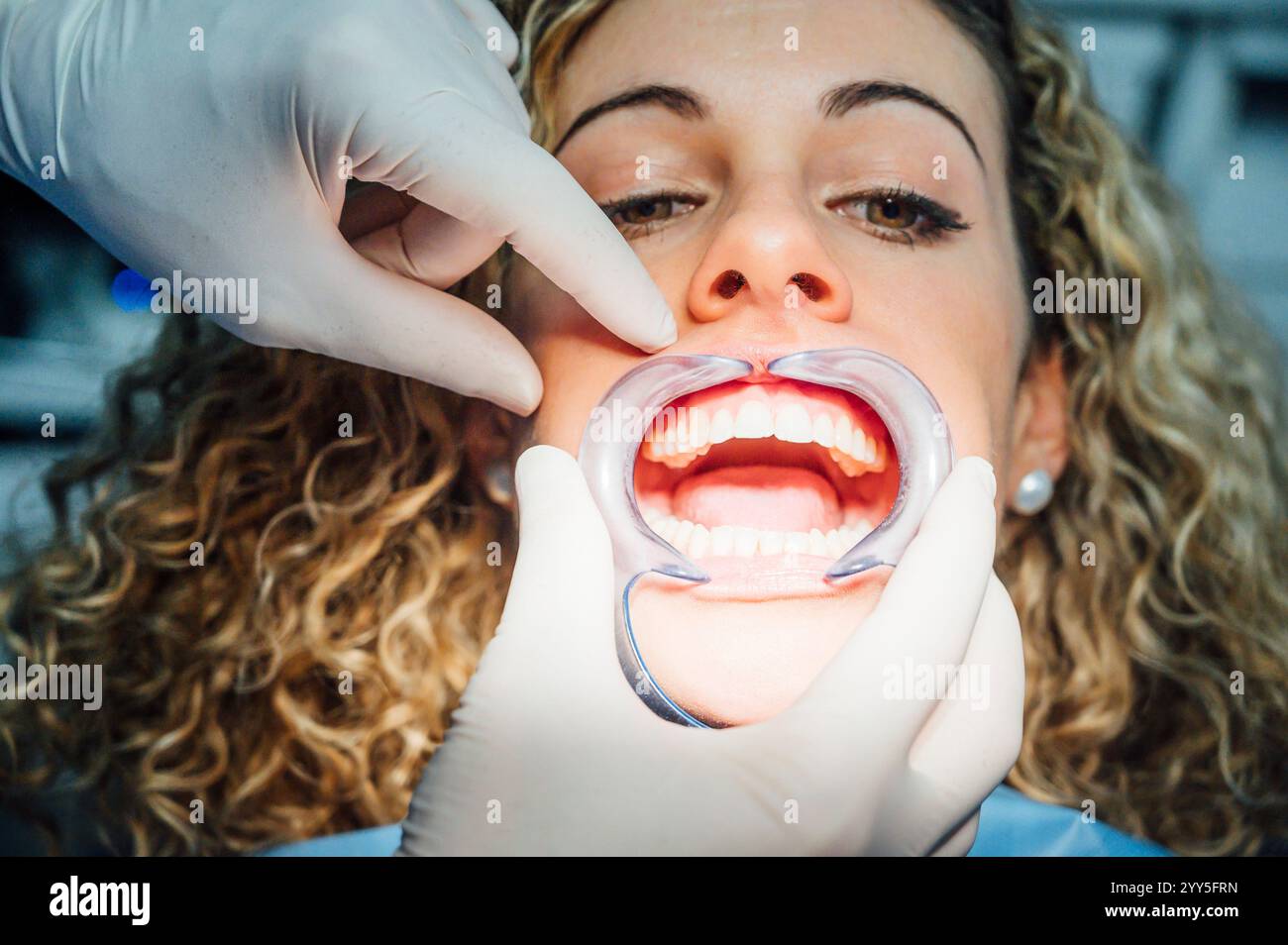 Young woman getting braces put on teeth Stock Photo - Alamy