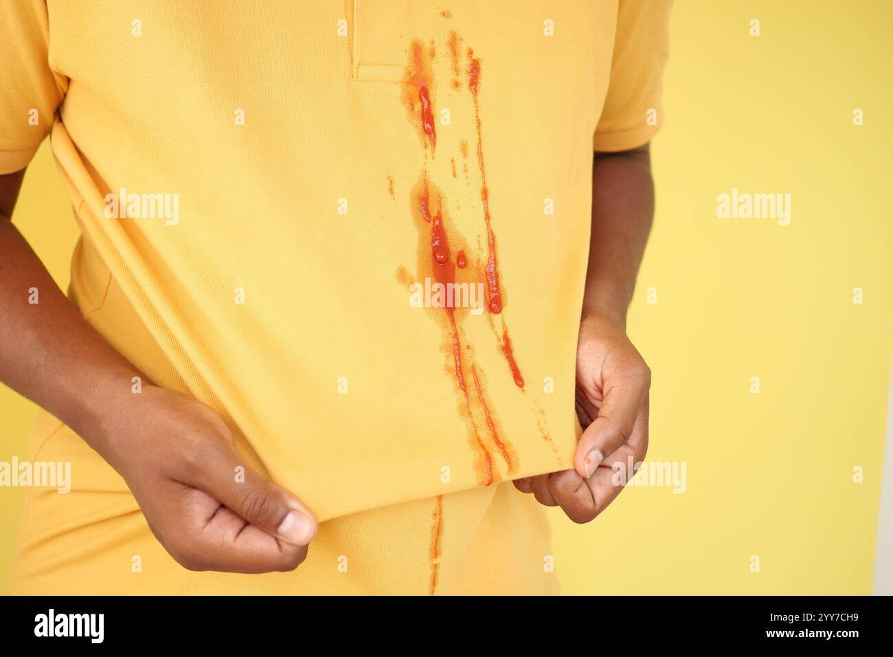 A yellow shirt was stained by spilled ketchup, requiring cleaning to ...