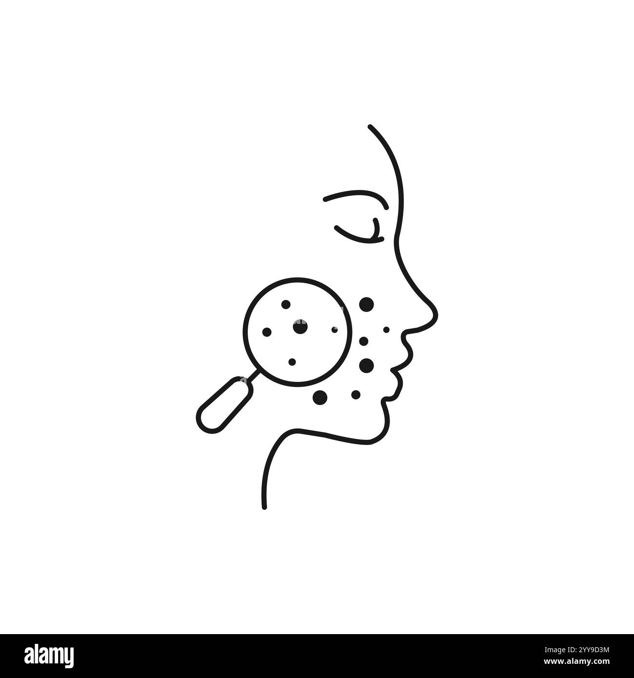 Problem of skin Black and White Stock Photos & Images - Alamy