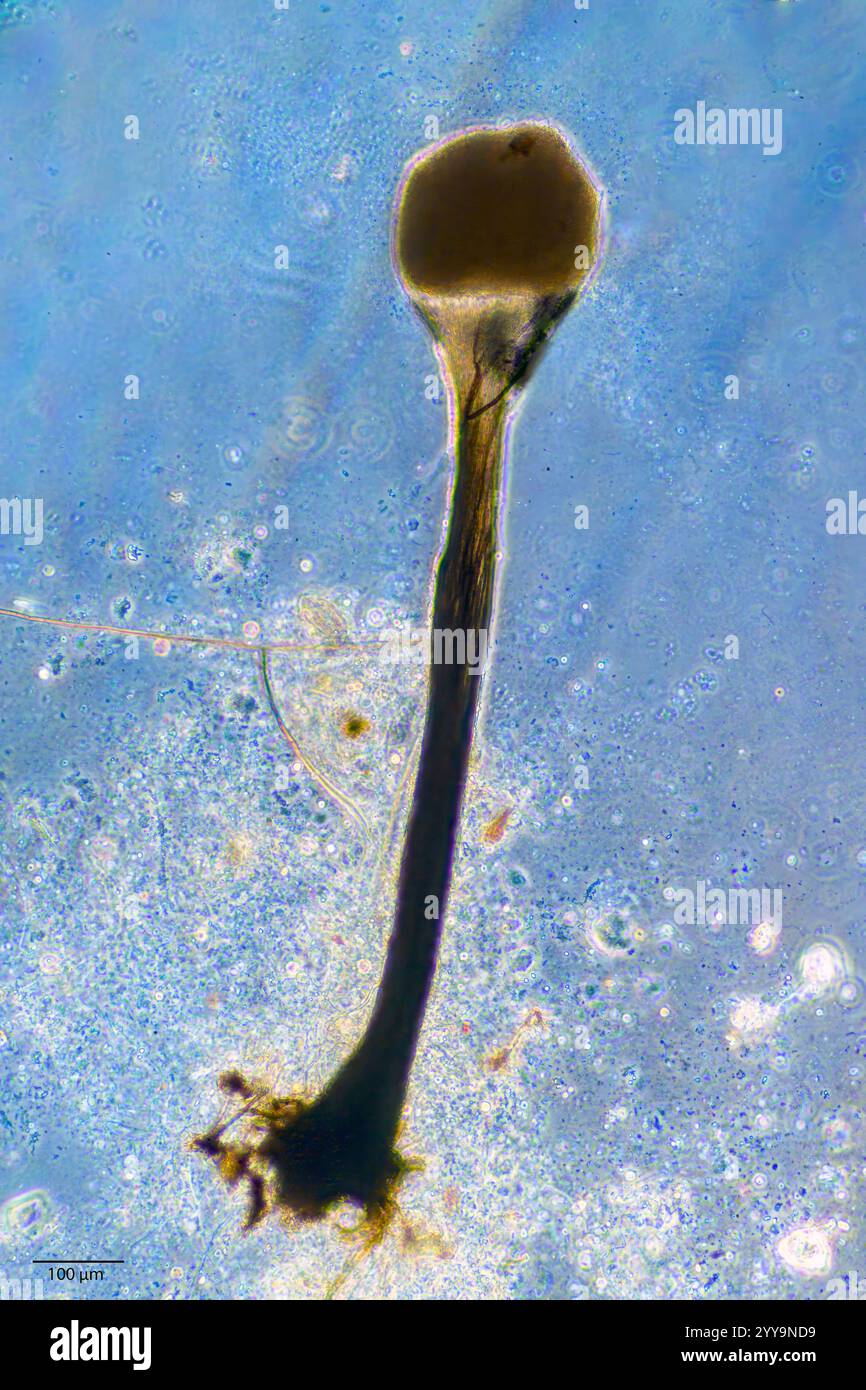 Immature sporocarp (fruiting body) of the Ascomycot fungi ...