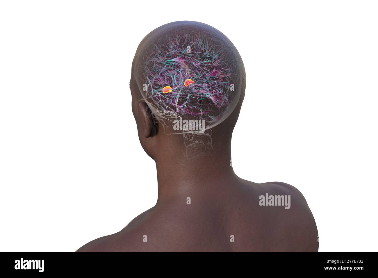 Computer illustration of the human brain with a highlighted amygdala ...