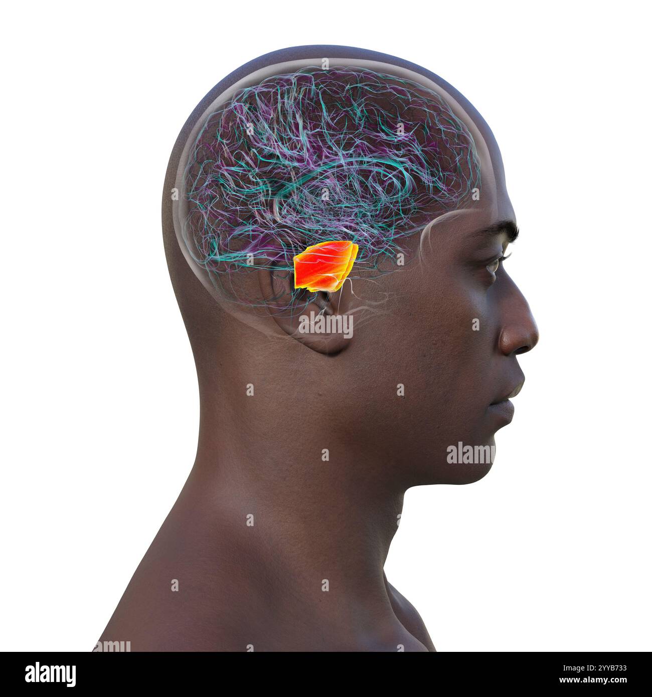 Computer illustration of the human brain with the pons highlighted in ...