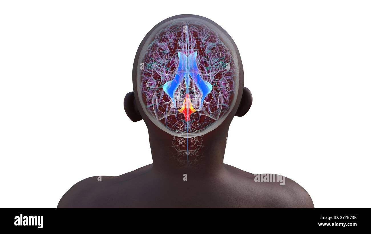 Computer illustration of the anatomy of the fourth brain ventricle ...